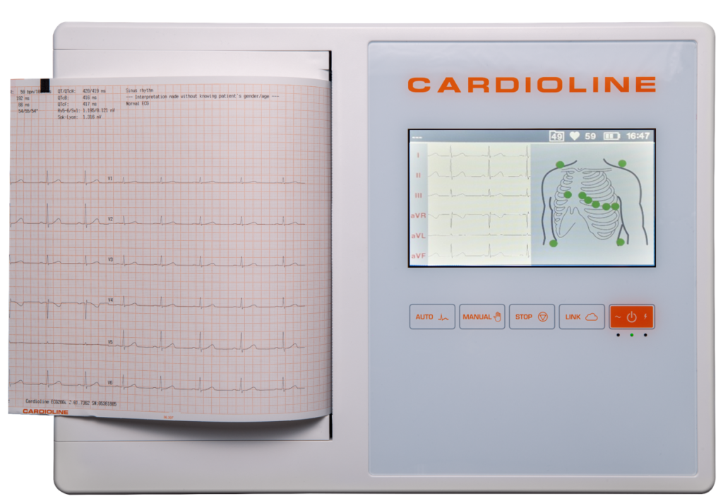 Cardioline ECG200L with Glasgow ECG Interpretation - margpharma.com