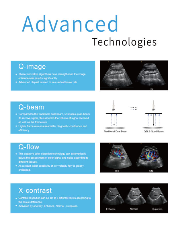 Chison QBit 9 Smart Ultrasound - margpharma.com