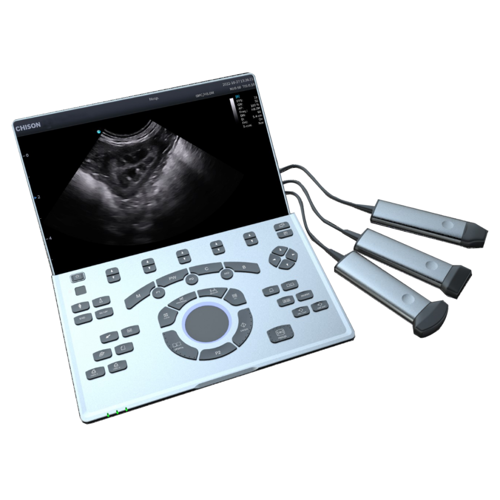 Chison SonoAir 70 Portable Ultrasound - margpharma.com